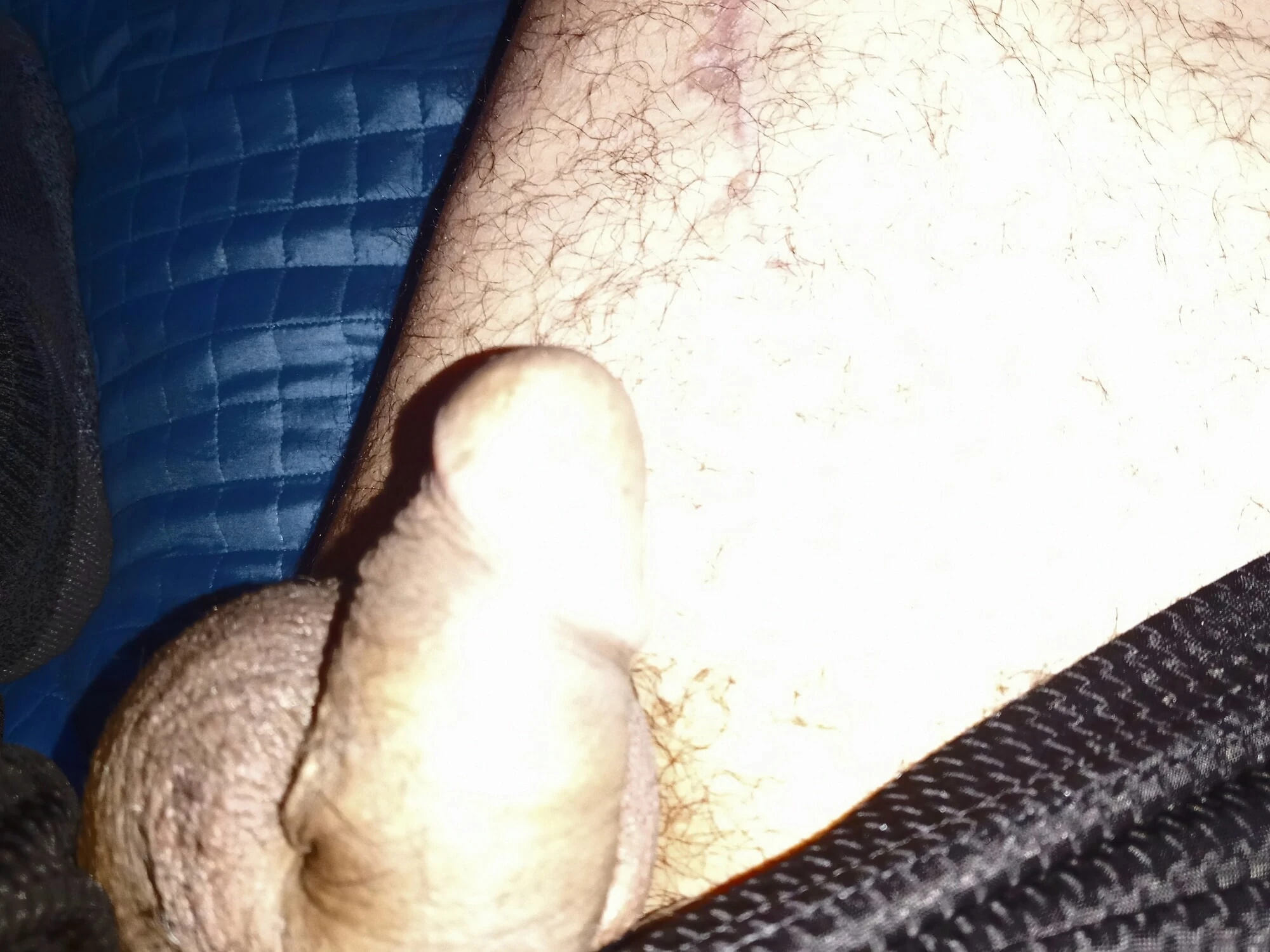 Circumcised Cock Relaxing 5 Nude Pics Xhamster