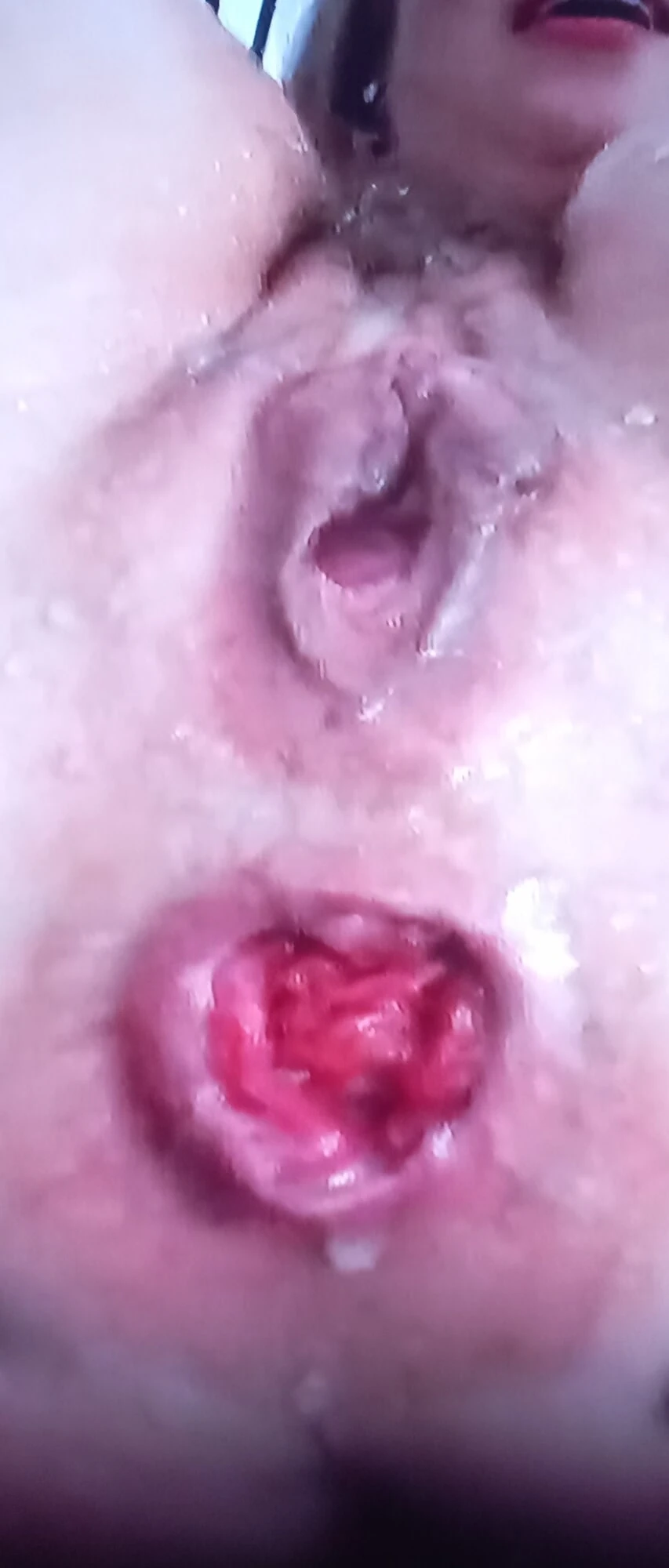 Open Hole 3 Pics Xhamster