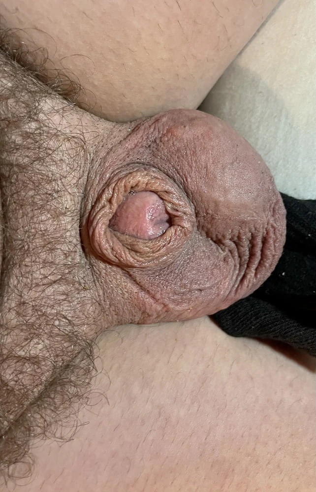 Micro Cock Tiny Penis Pictures 23 Pics Xhamster