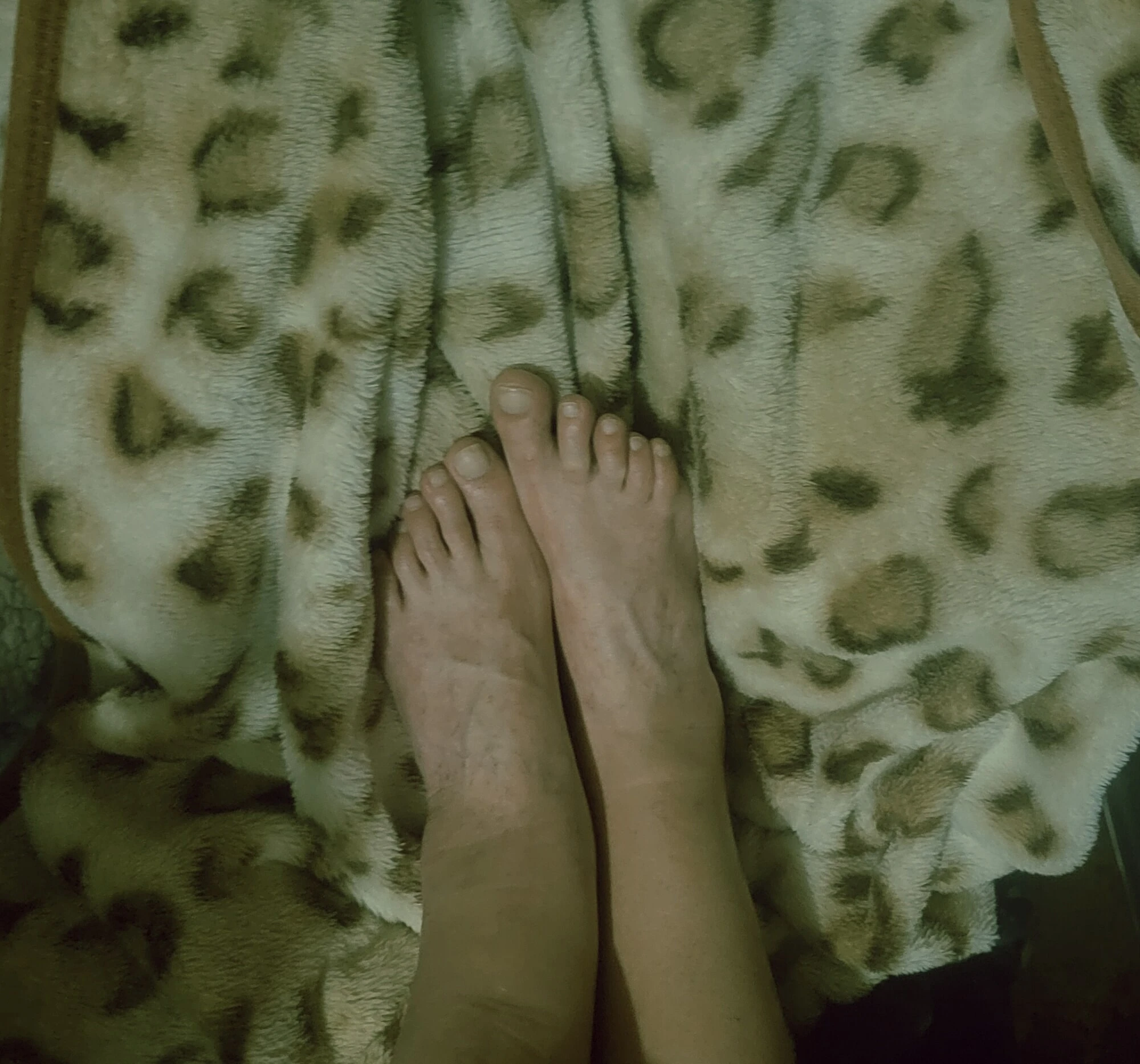 Big Sexy Ugly Feet 4 Nude Pics Xhamster
