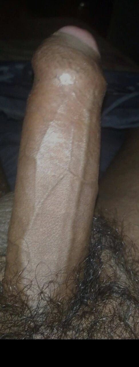 Dick Head 5 Nude Pics Xhamster