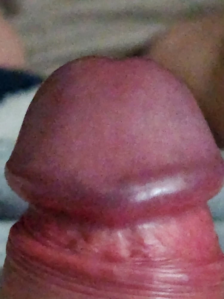My Big Uncut Cock 12 Nude Pics Xhamster