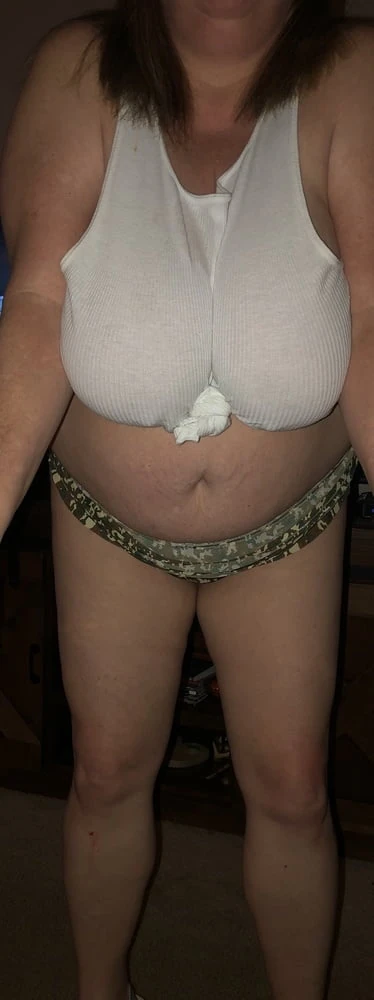 Trashy Slut 72 Pics 2 Xhamster 8045